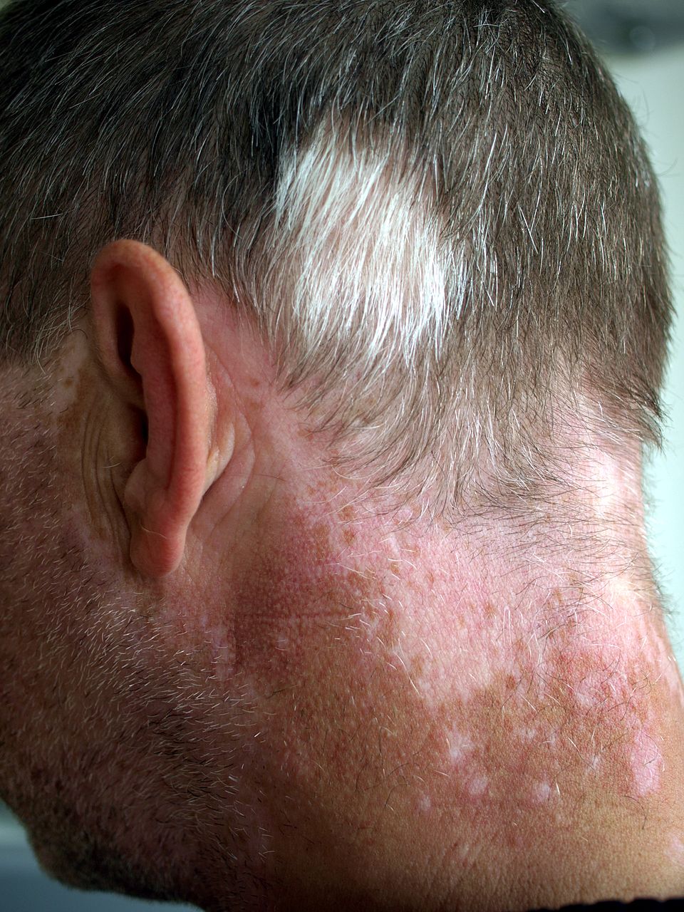 People With Rare Genetic Traits You Don’t See Every Day - Kate Knows