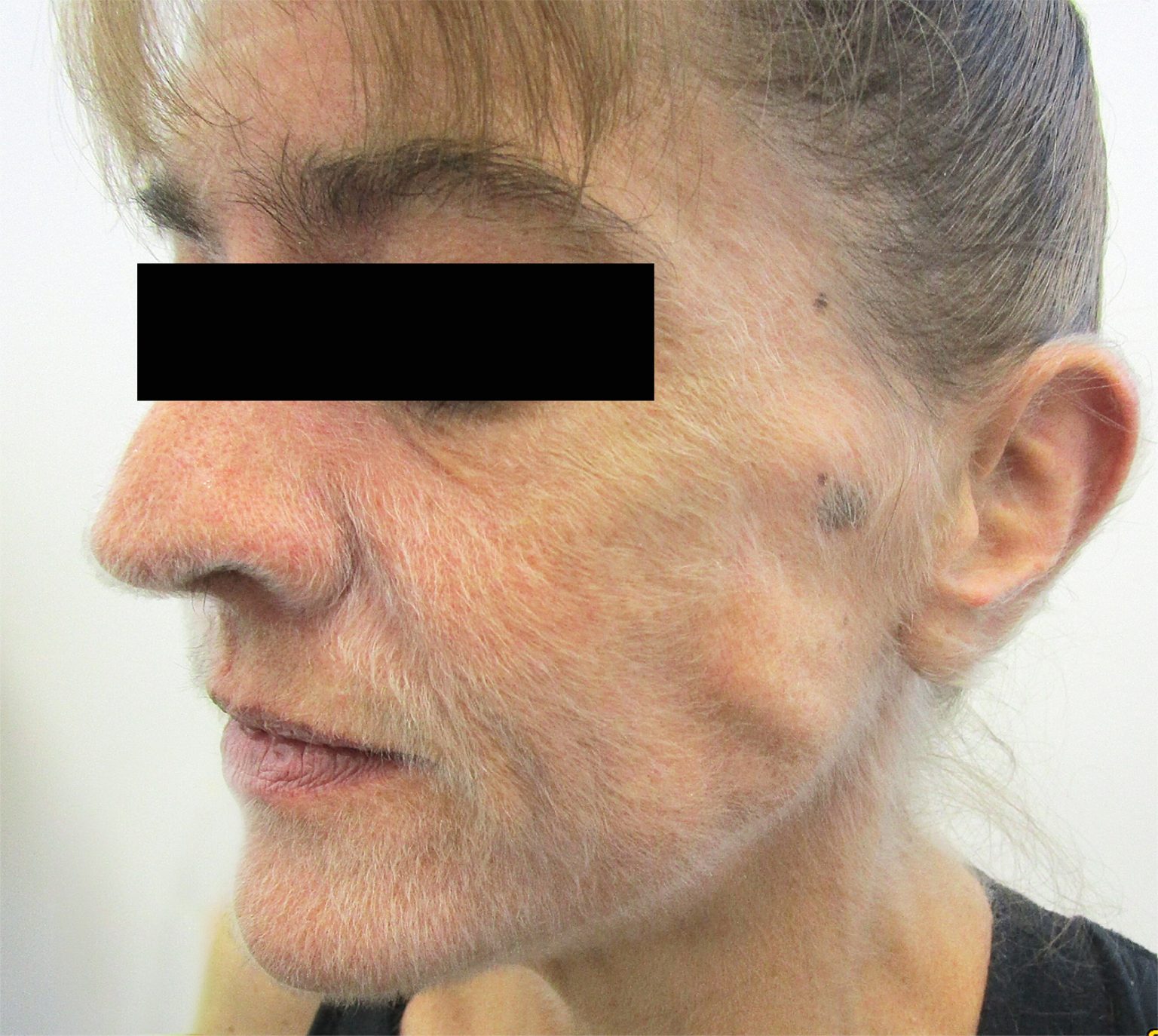 People With Rare Genetic Traits You Don’t See Every Day - Kate Knows