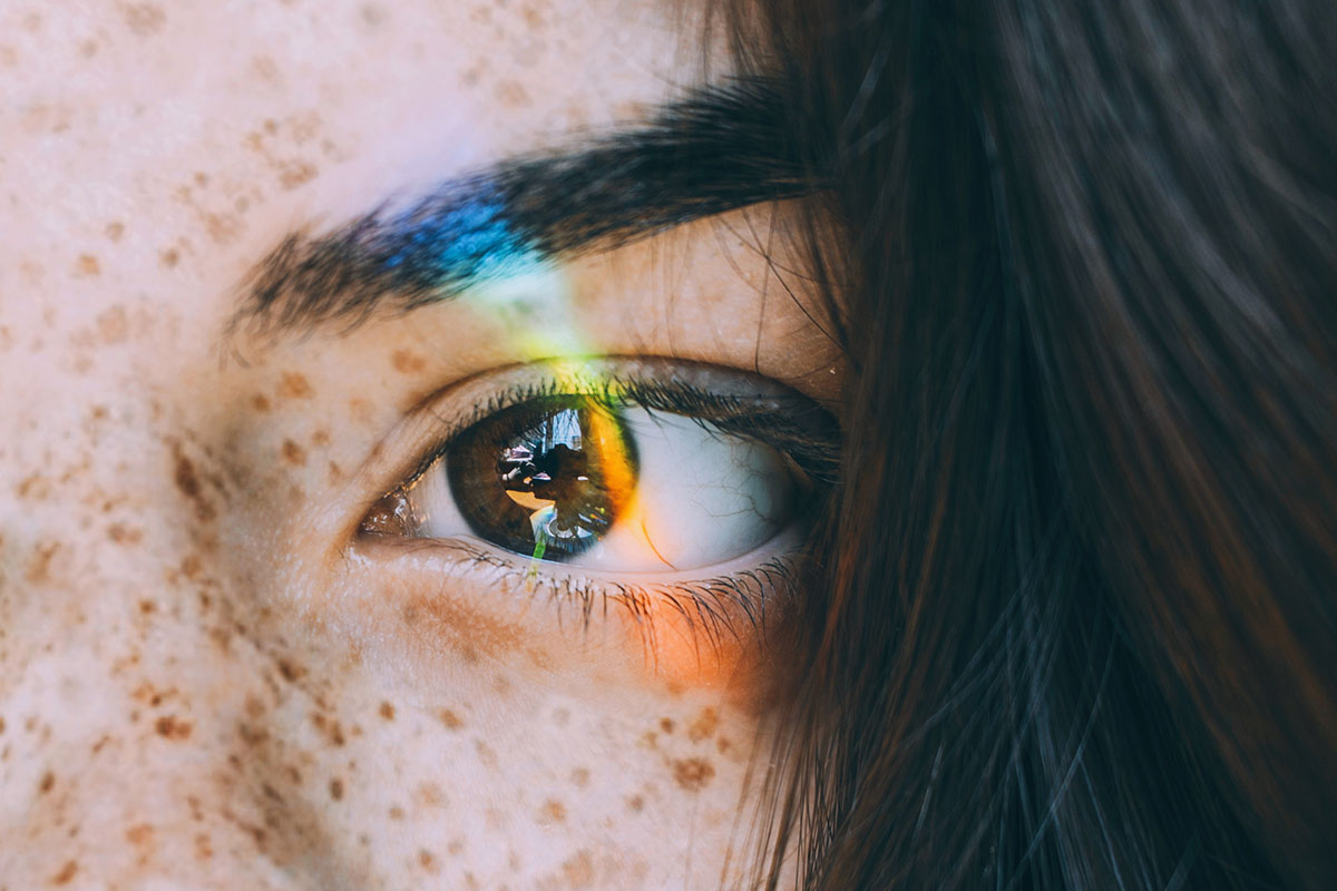 People With Rare Genetic Traits You Don’t See Every Day - Kate Knows