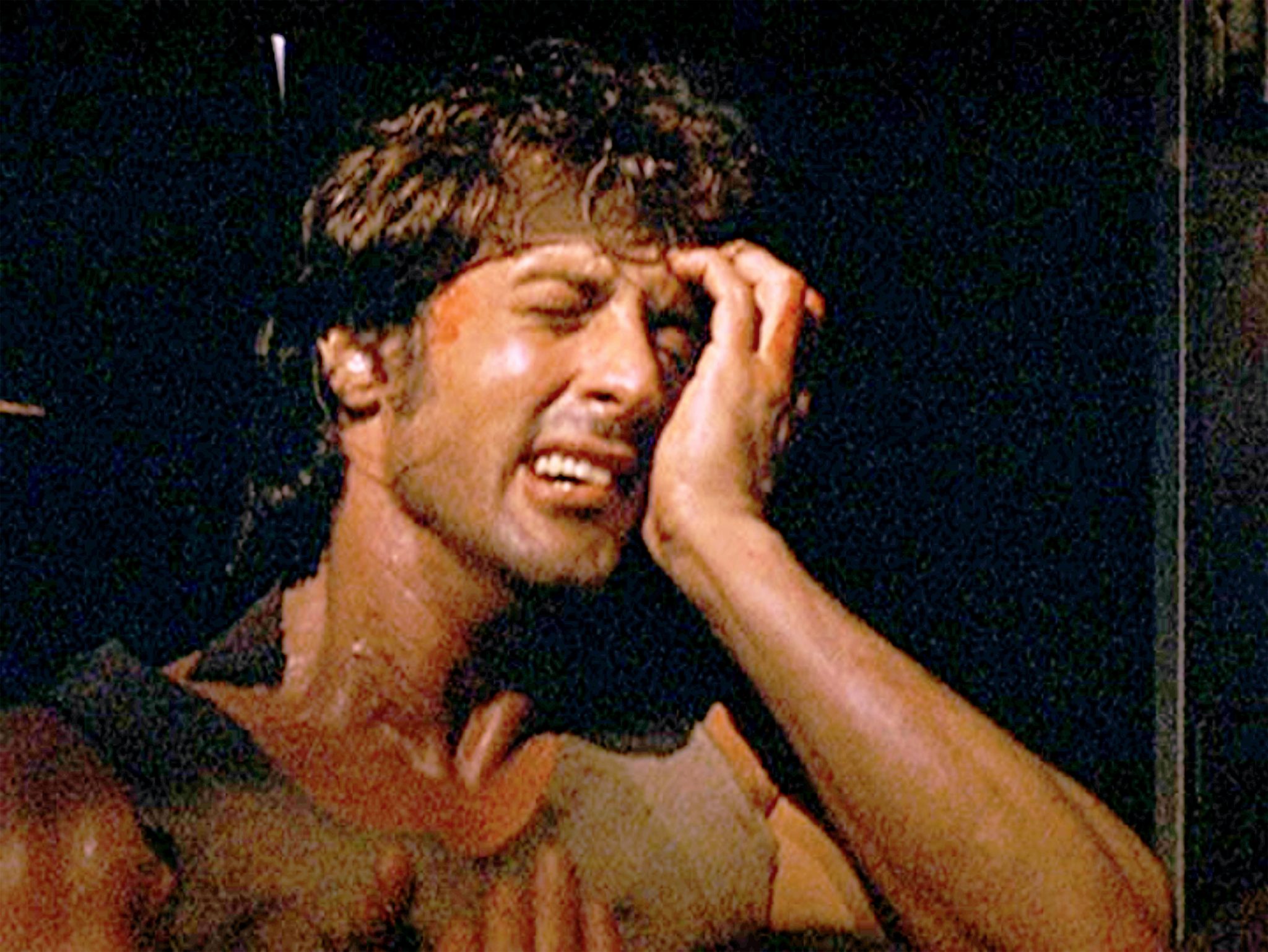 25 Times Real Injuries Became Part Of The Script - Kate Knows