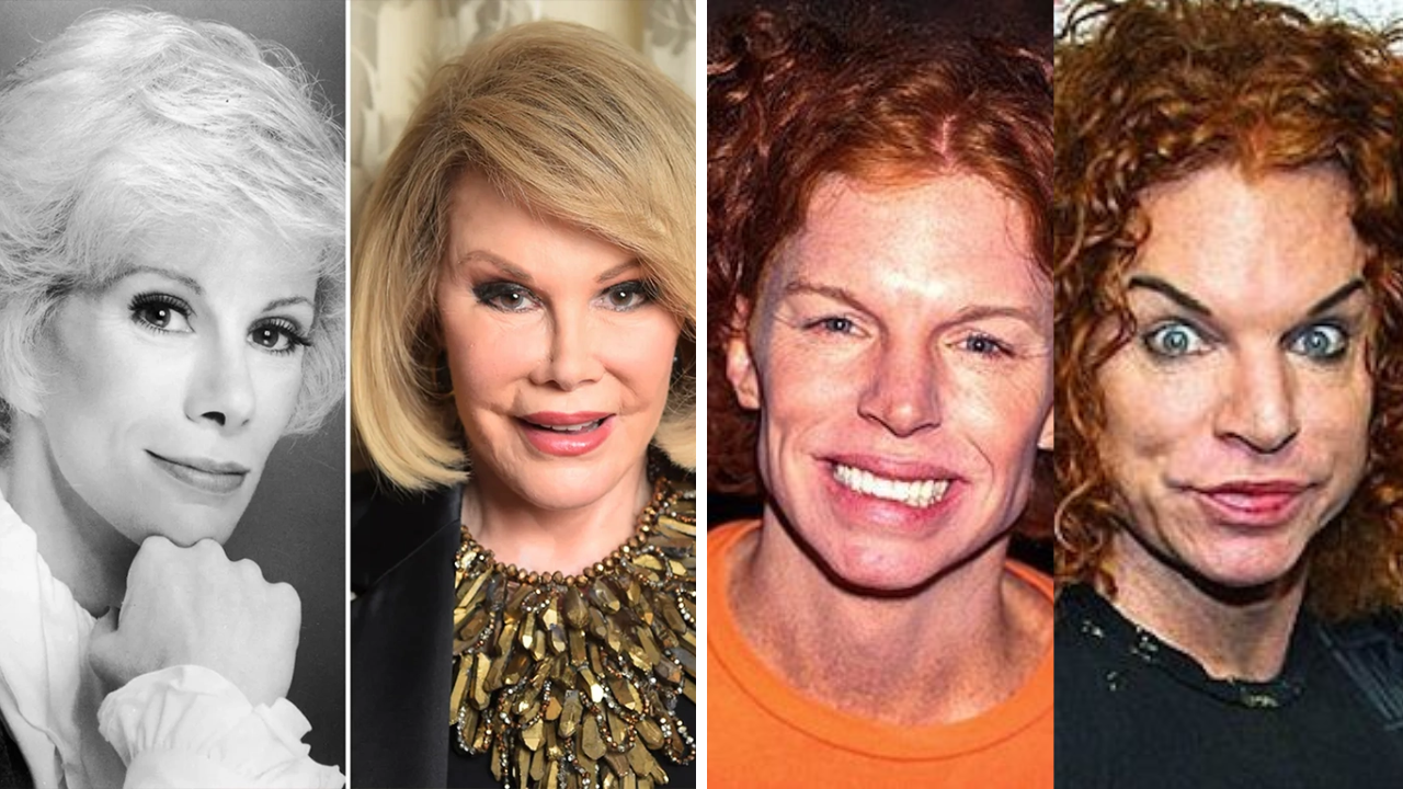 28 celebrities whose appearance changed after plastic surgery - Kate Knows