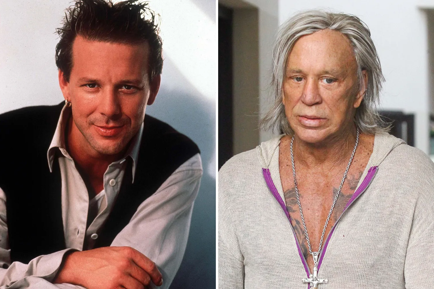 28 celebrities whose appearance changed after plastic surgery - Kate Knows
